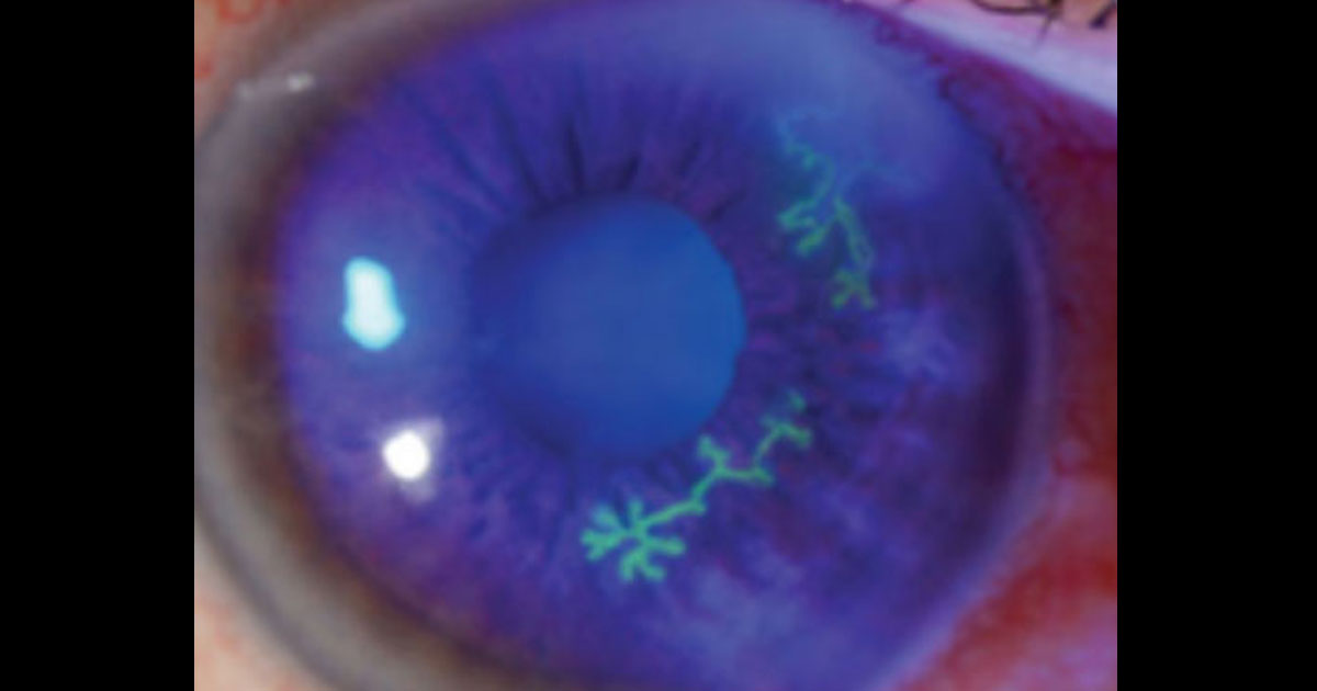 Summer 2017 GP Newsletter